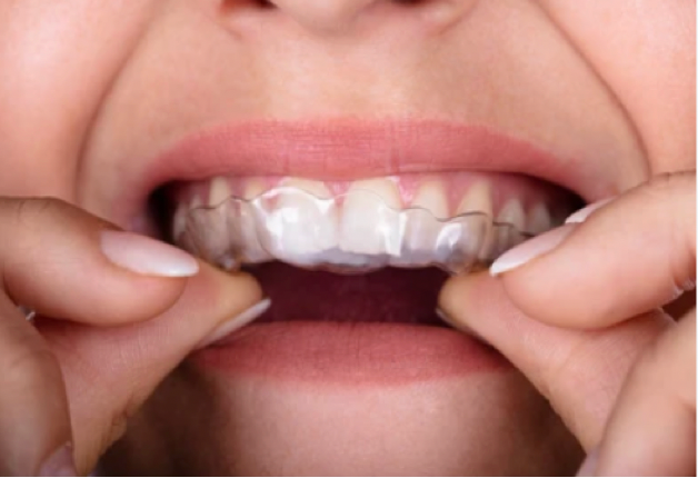 Invisalign Information Morton Grove IL, How Does Invisalign Work
