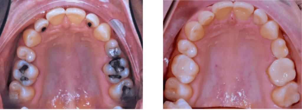 Holistic Dentistry Morton Grove IL, ProCare Family Dental