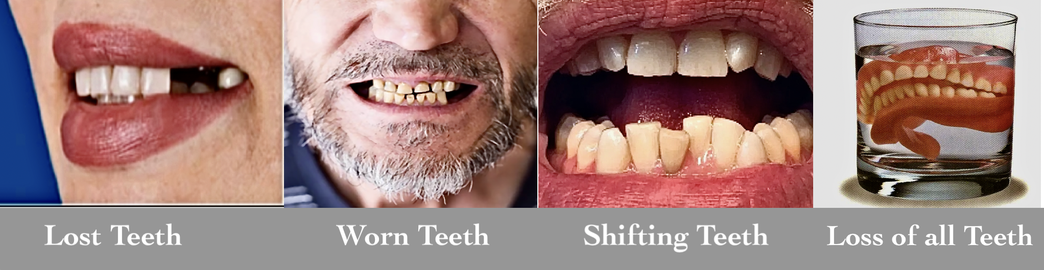 Dental Anxiety Morton Grove IL, ProCare Family Dental