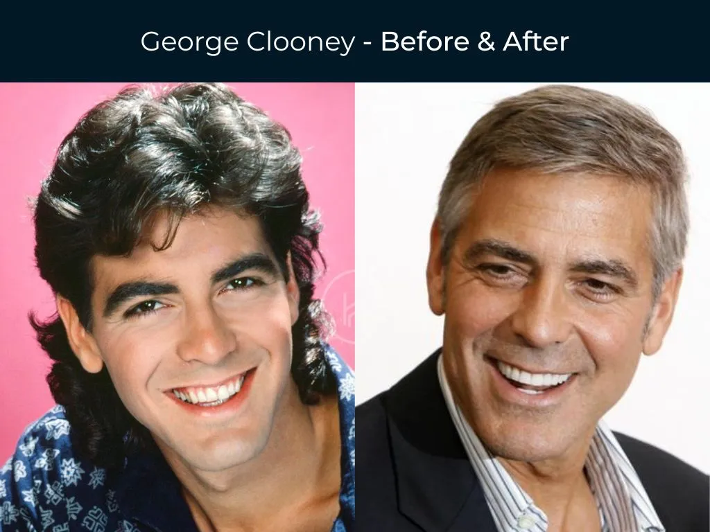 Celebrity Smiles: Cosmetic Dentistry in Morton Grove, IL