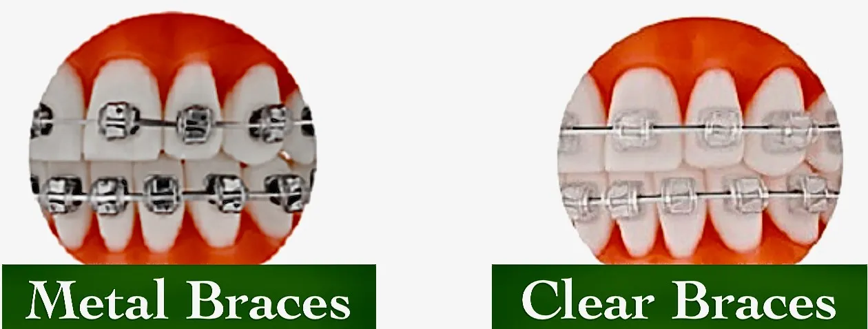 Orthodontic Treatment Morton Grove IL, What Is Orthodontics