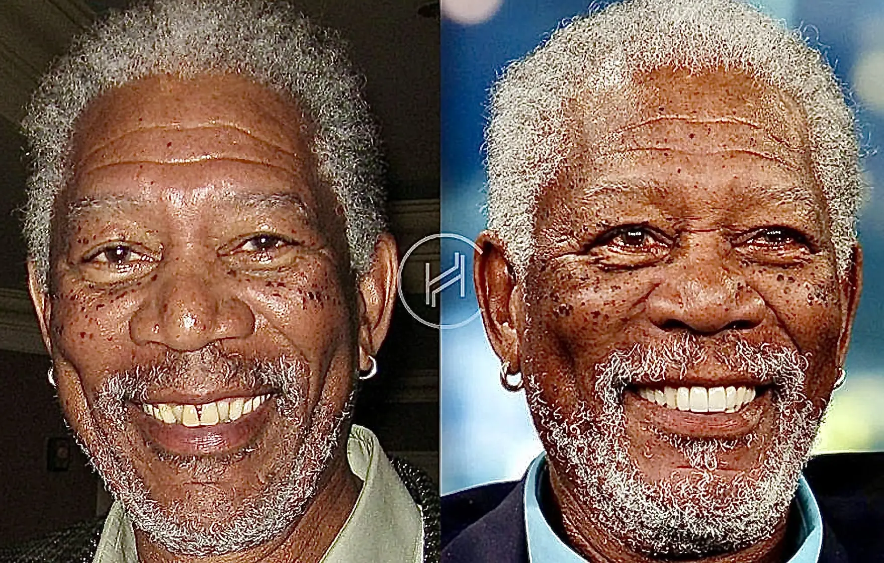 Celebrity Smiles: Cosmetic Dentistry in Morton Grove, IL