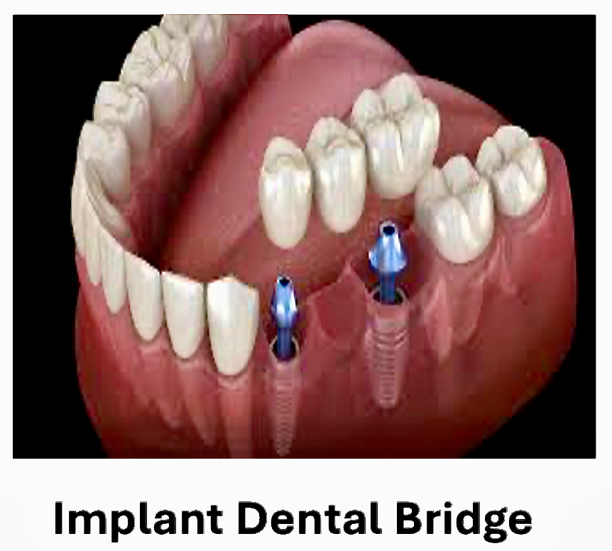 Partial Dentures Morton Grove IL | Dentures