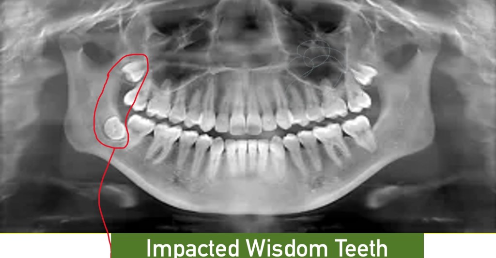 Dentist Morton Grove IL | Cosmetic Dentistry